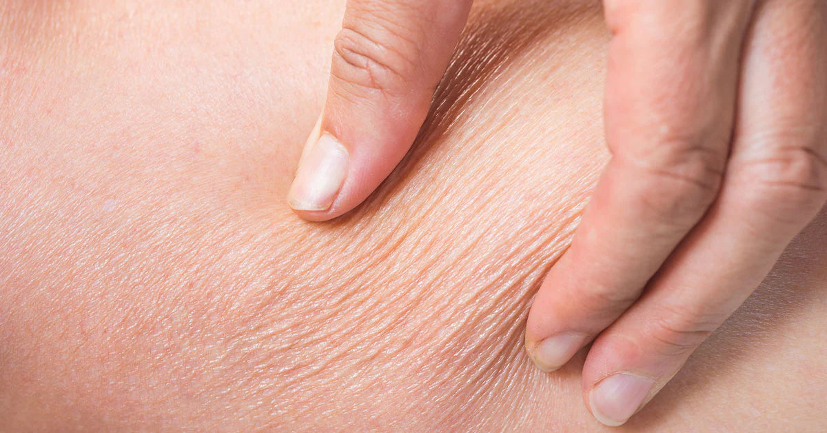 Signs of Dehydration in Your Skin - Solvaderm