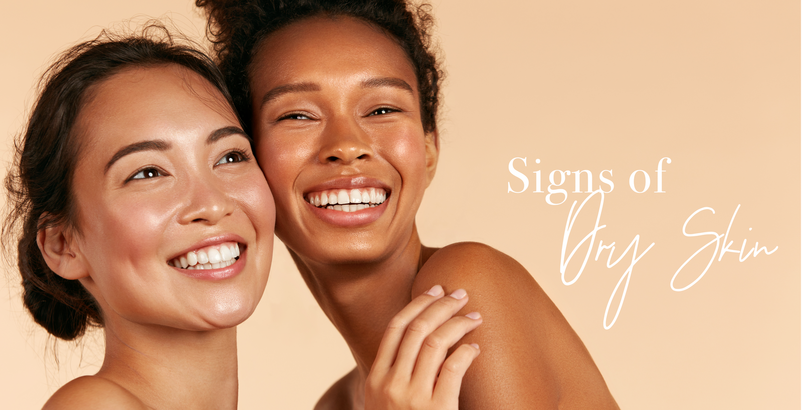 What are the Signs and Symptoms of Dry Skin?