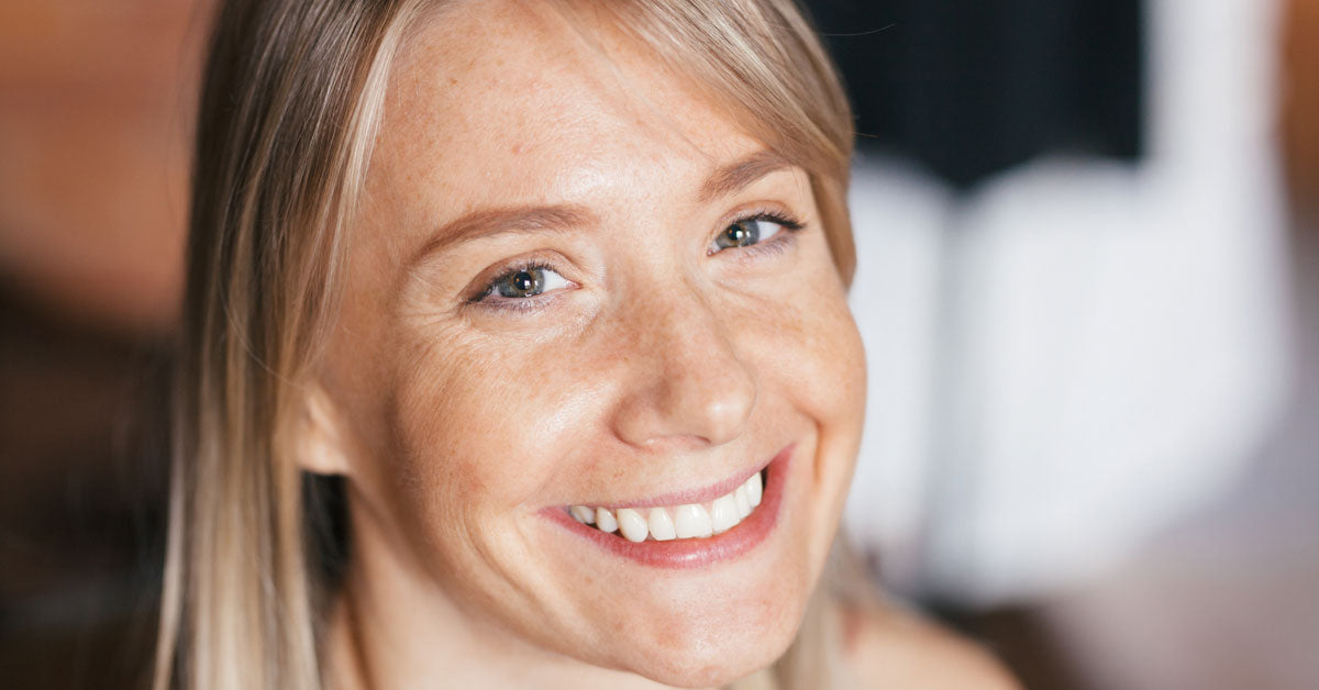 Sunspots on Skin - How to Treat and Remove Them Safely – Solvaderm